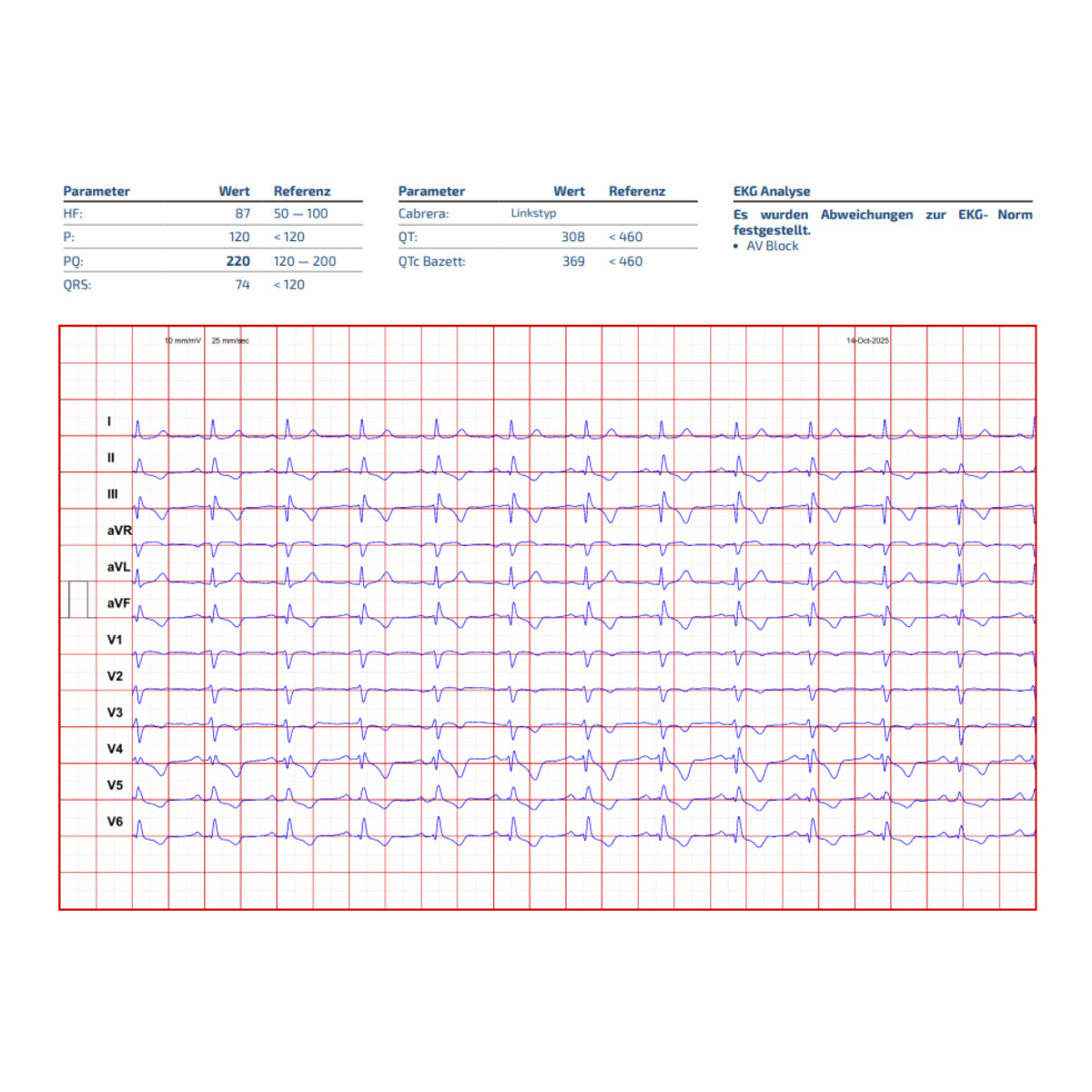 CARDISIO Cardisio 3D-Herz-Screening online kaufen